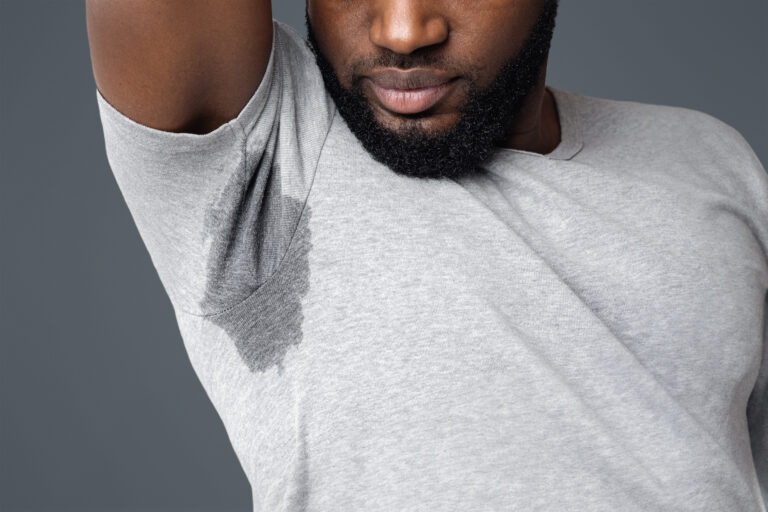 Excessive Sweating (Hyperhidrosis) - Integrated Dermatology | Serving ...